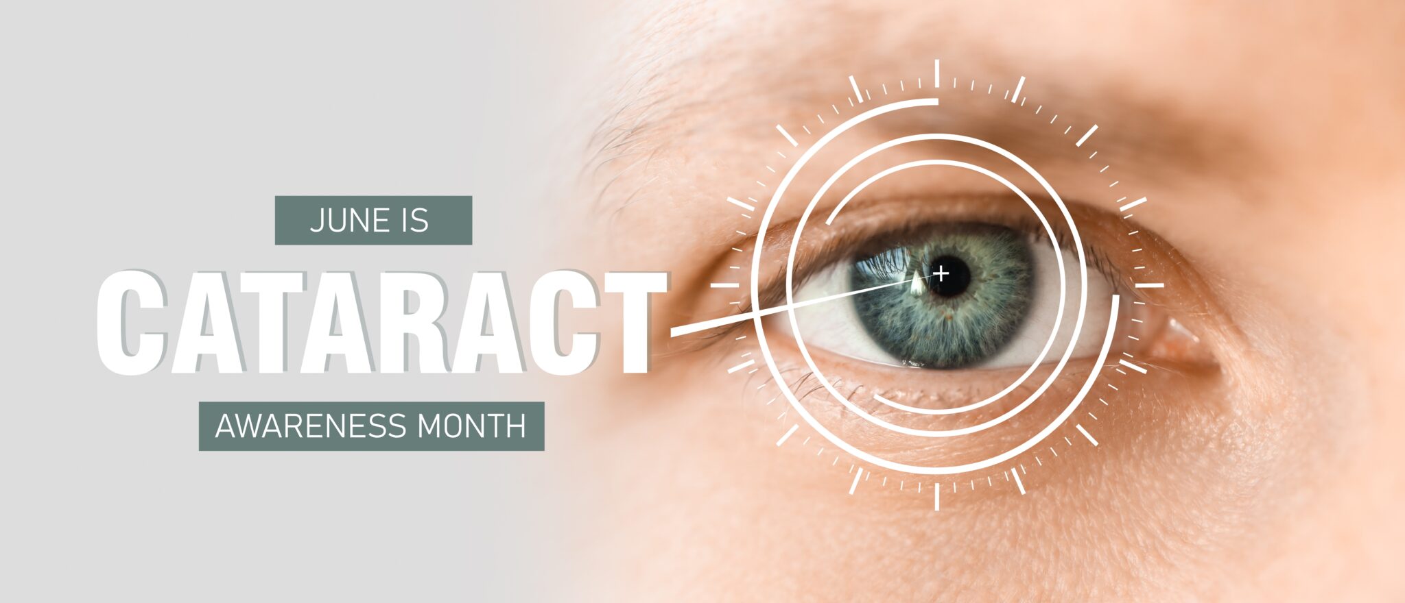 June Cataract Awareness: Quick Notes | Slade & Baker Vision