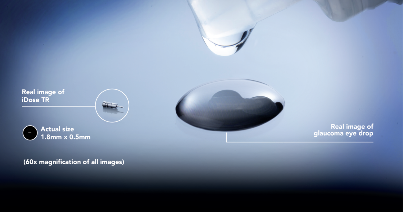 What is iDose? | Slade & Baker Vision